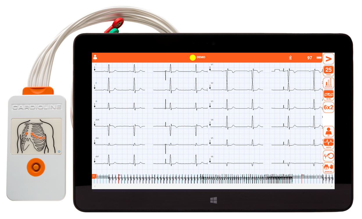 PC-EKG
